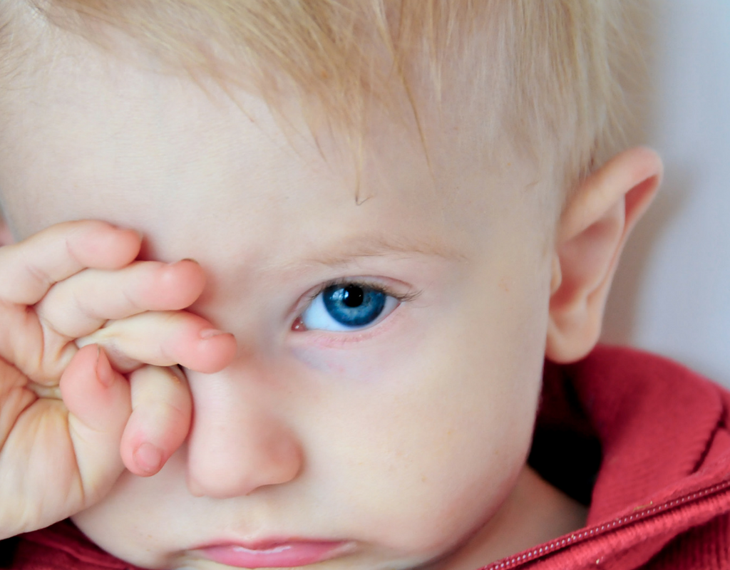 Pink Eye In Toddlers